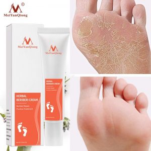 FungiShield Anti-Fungal Athlete's Foot Cream - Juhi